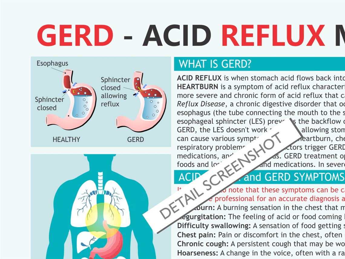 Gerd-allowed Foods, Acid Reflux Chart, Heartburn Management Chart ...