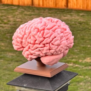 3D Printed Mri-scanned Human Brain Model Perfect for Medical Learning ...