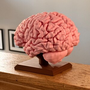 3D Printed Mri-scanned Human Brain Model Perfect for Medical Learning ...