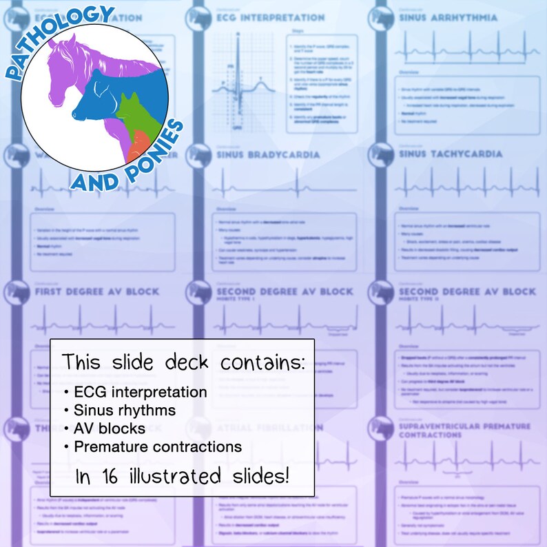 Ecgs and Cardiac Arrhythmias Explained - Step-by-step Visual Guide for ...