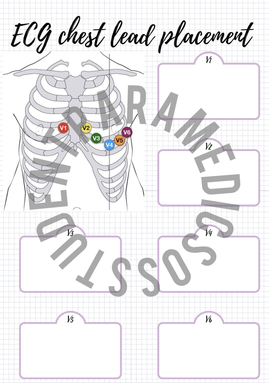 ECG Chest Lead Placement - Student Paramedic Revision Worksheet - Etsy