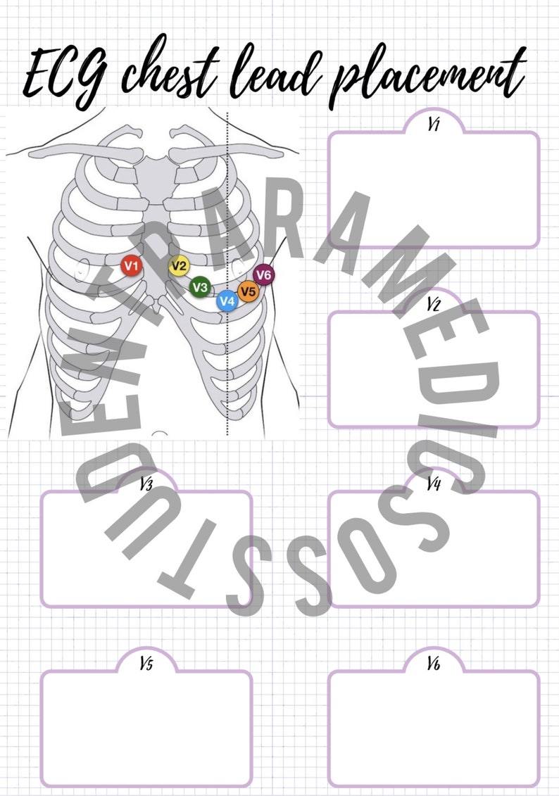 ECG Chest Lead Placement - Student Paramedic Revision Worksheet - Etsy