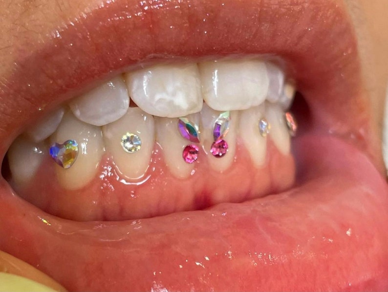 DIY Toothgem Kit Zahnschmuck Set All in one Homeset Zahnsteinchen ...