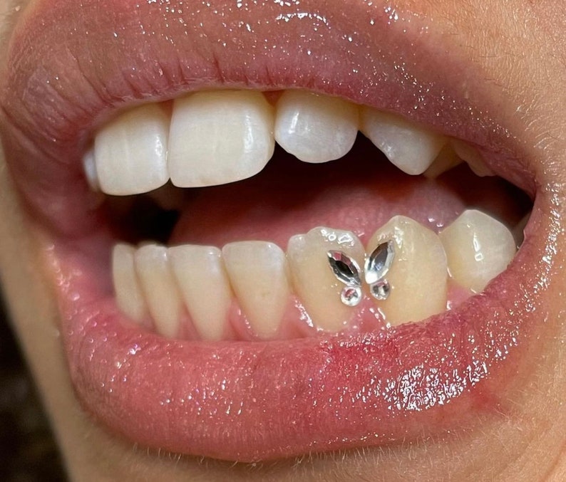 DIY Toothgem Kit Zahnschmuck Set All in one Homeset Zahnsteinchen ...