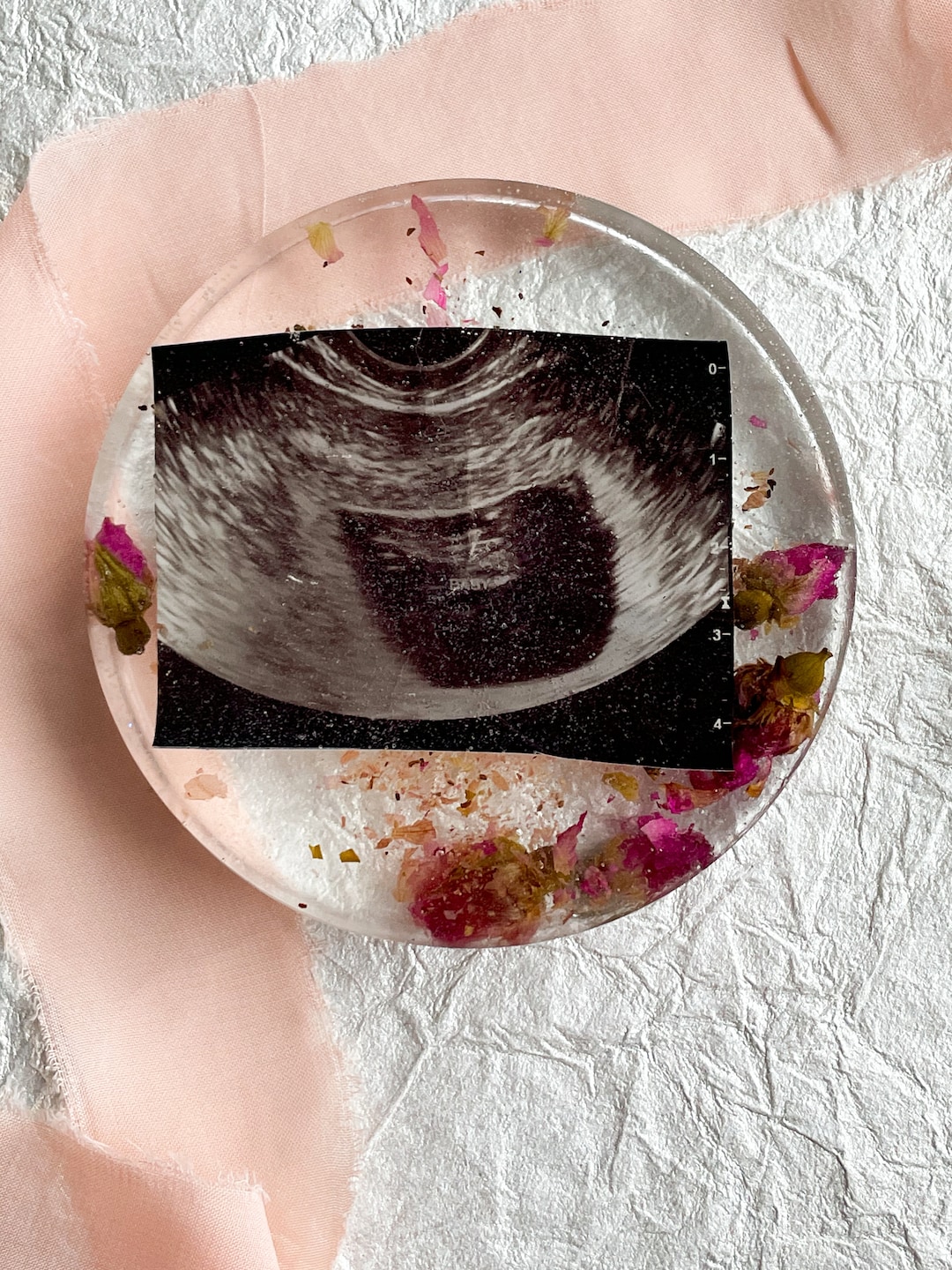 Ultrasound Design - Etsy