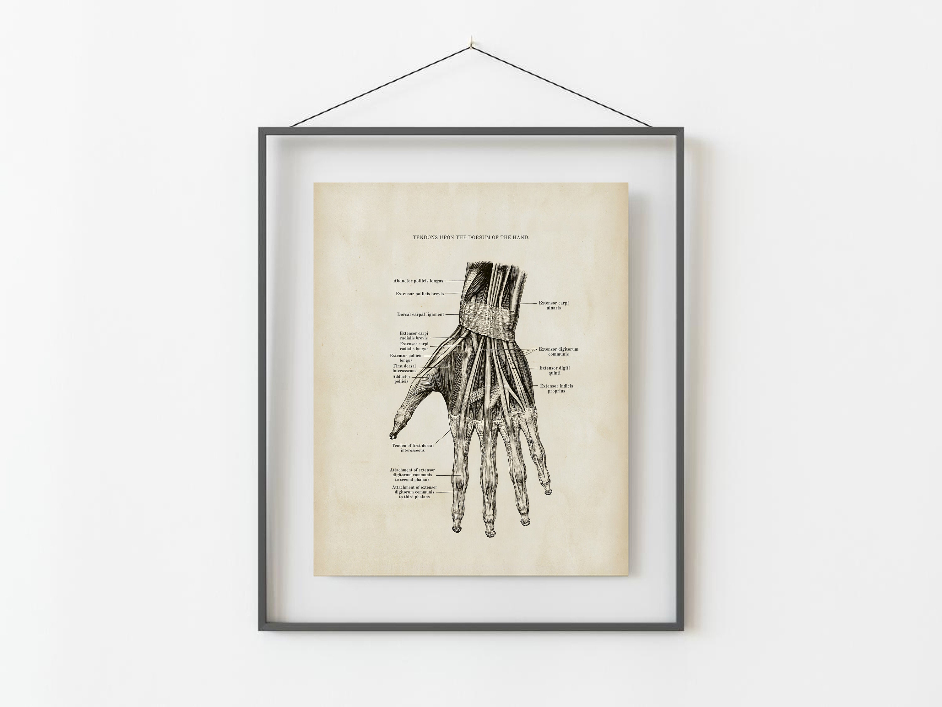 Vintage Anatomy Art Print: Tendons of the Hand (digital Download) - Etsy