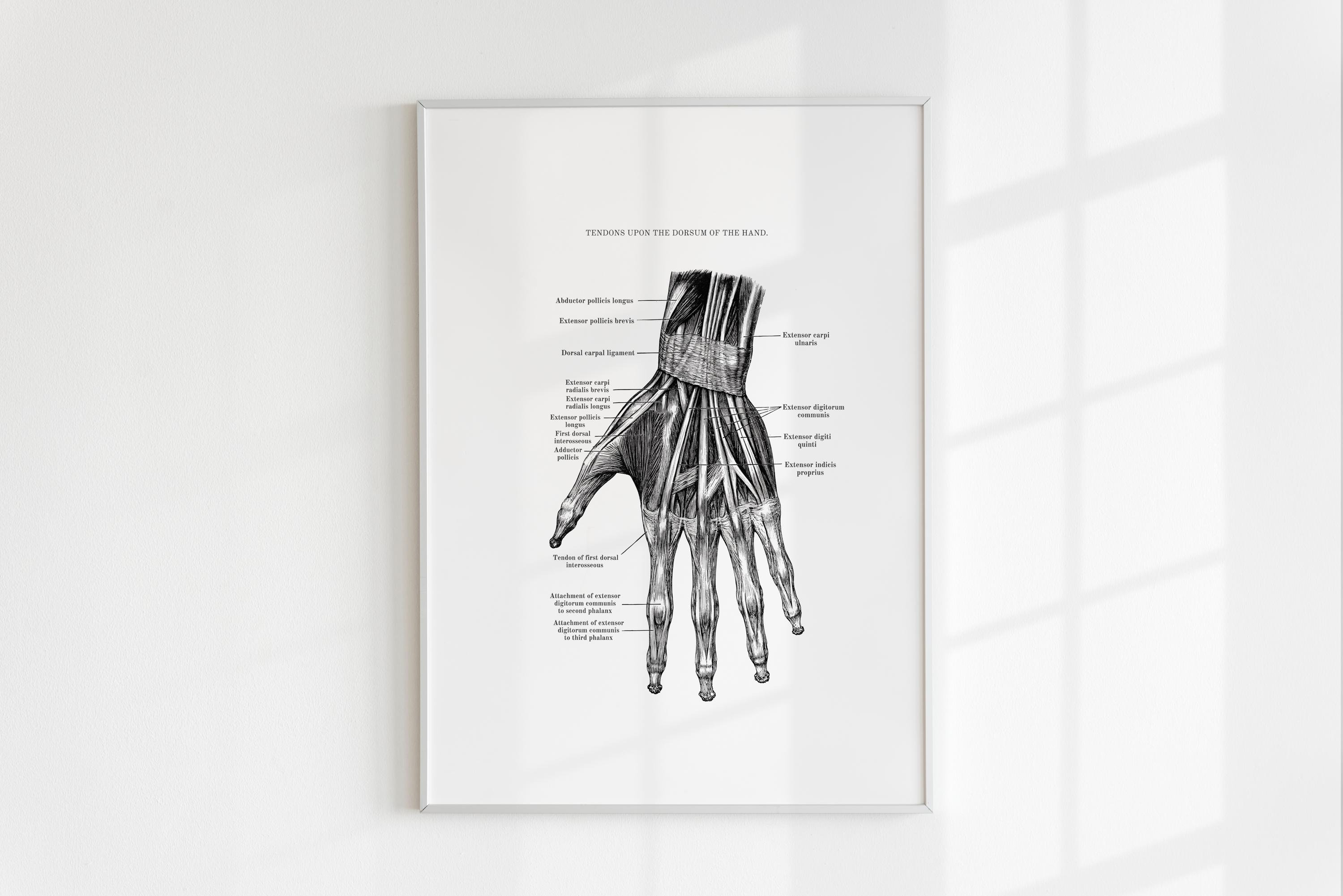 Hand Anatomy Art Print: Vintage Scientific Poster (digital Download) - Etsy