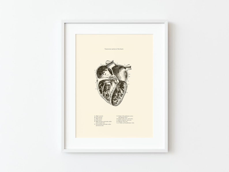 Anatomical Heart Print - Printable Wall Art - Heart Wall Art - Vintage ...