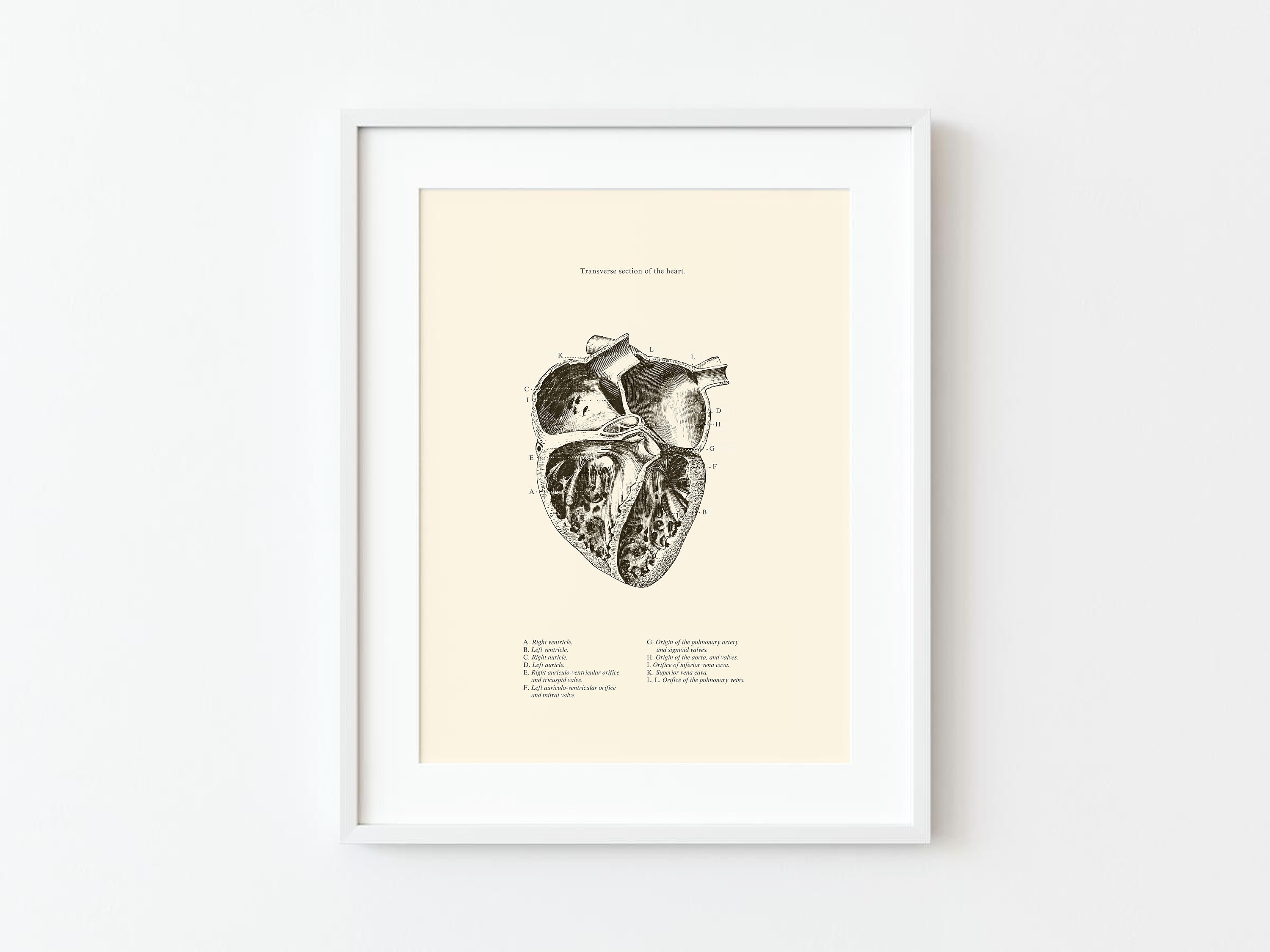 Anatomical Heart Print - Printable Wall Art - Heart Wall Art - Vintage ...