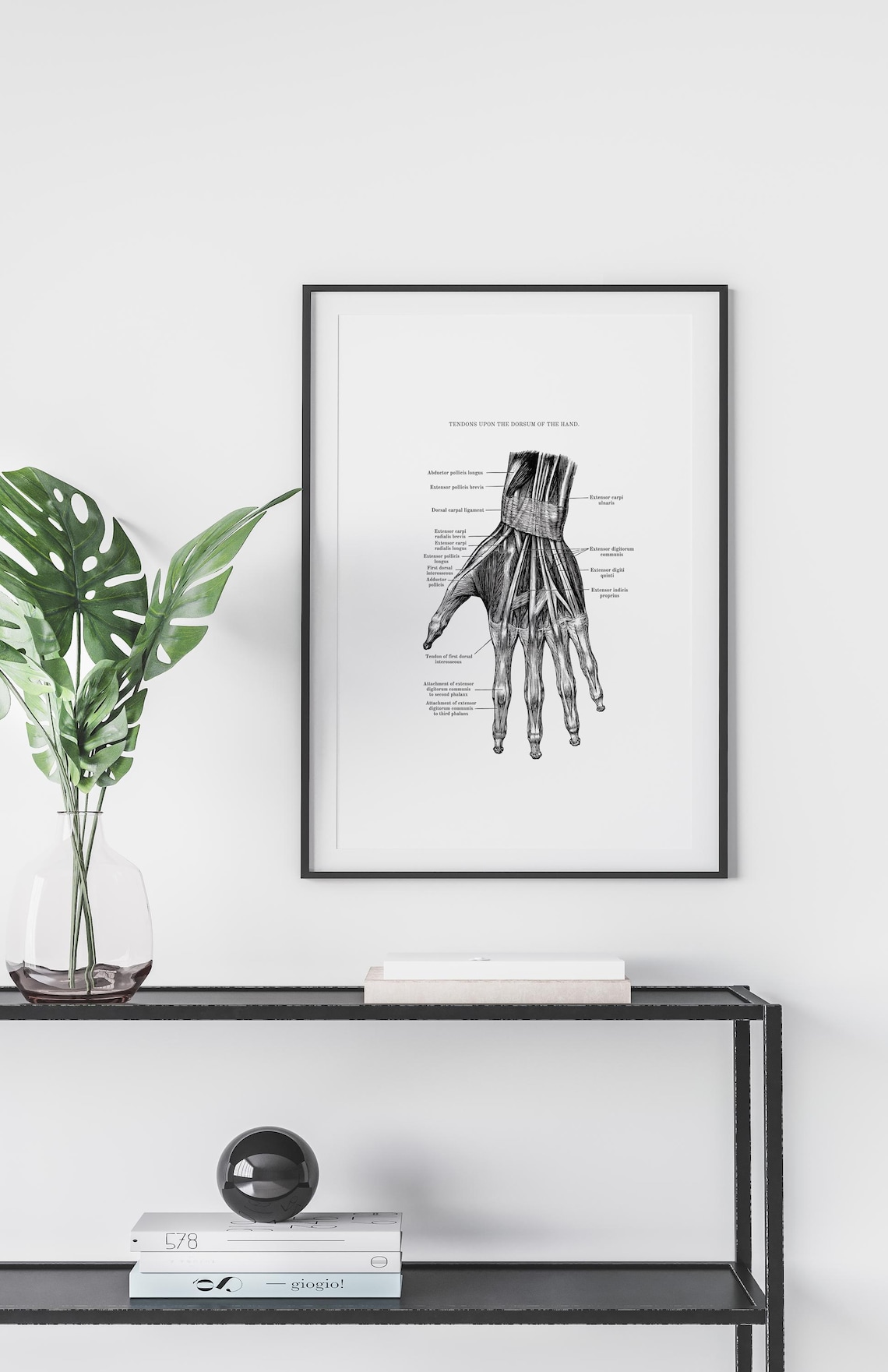 Hand Anatomy Art Print: Vintage Scientific Poster (digital Download) - Etsy