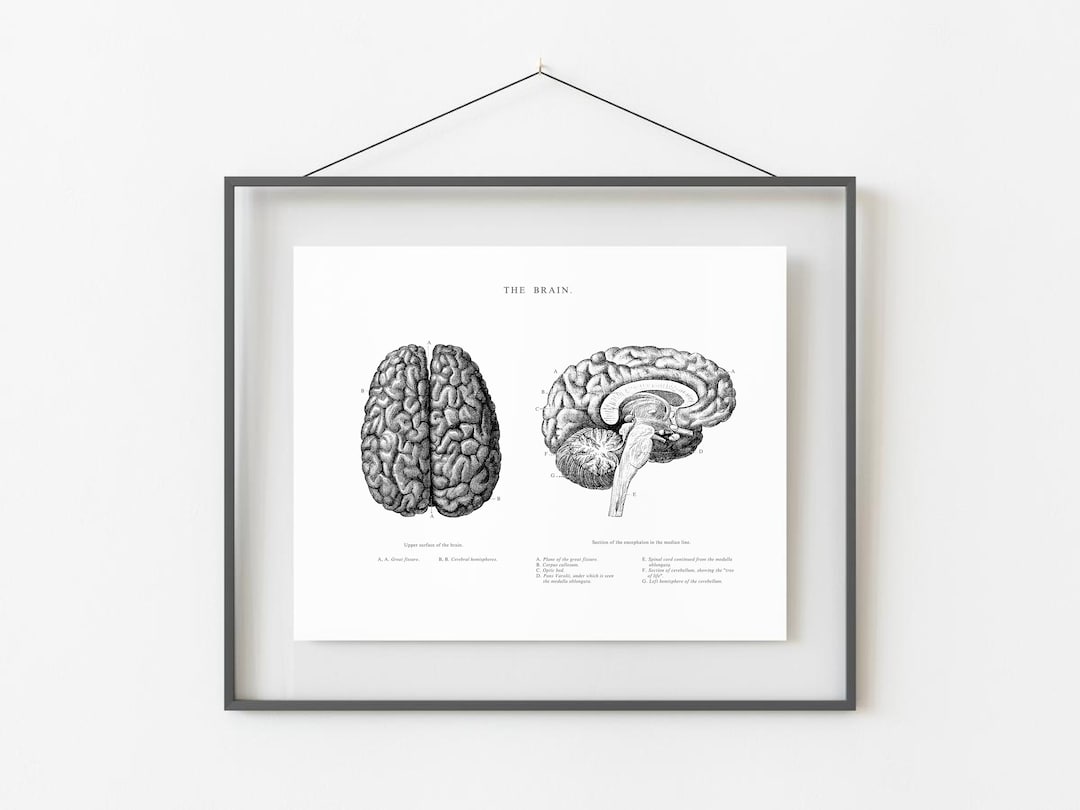 Anatomical Brain Print - Printable Wall Art - Brain Wall Art - Vintage ...