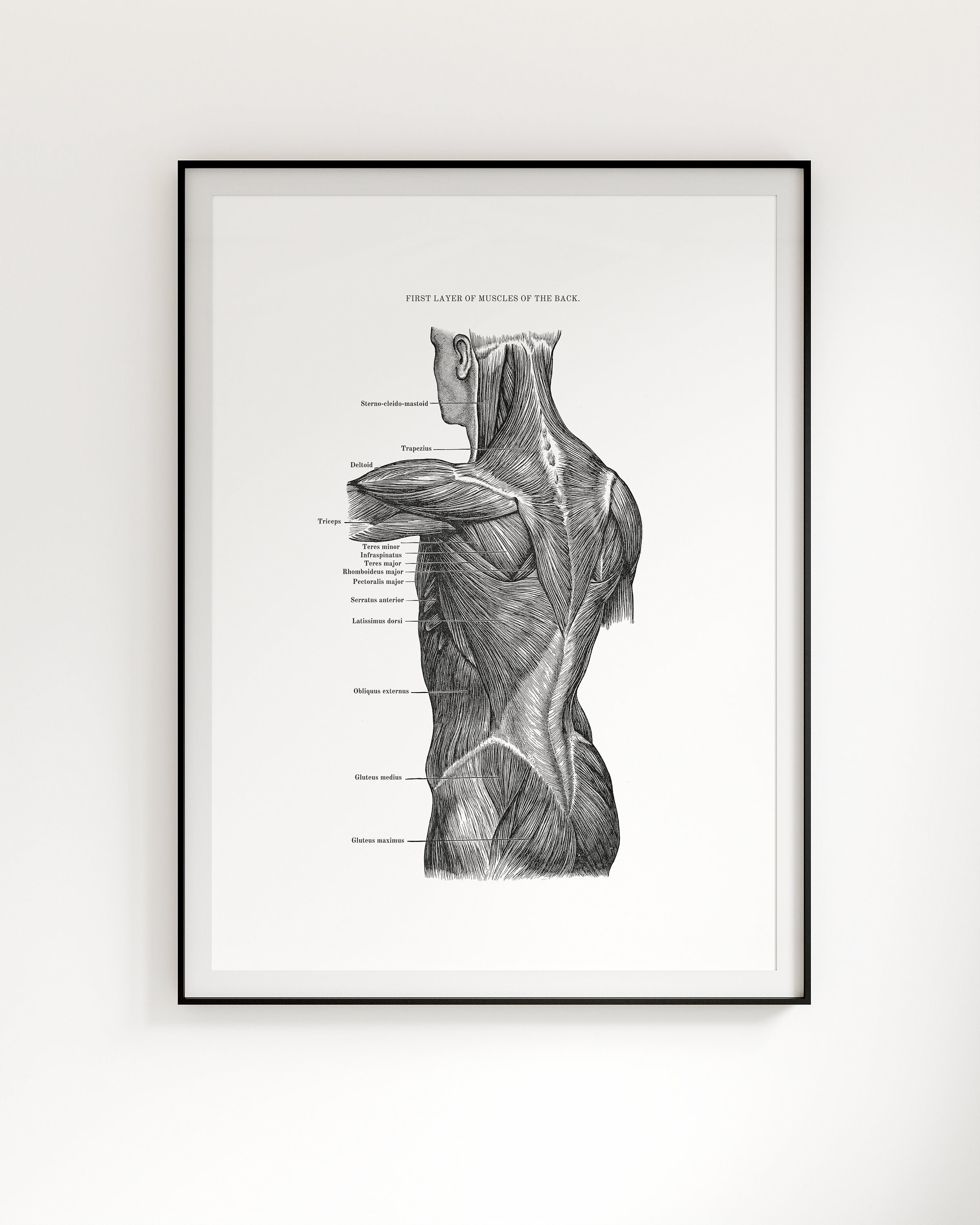 Muscles of the Back Print - Anatomy Art Printable - Vintage Anatomy ...