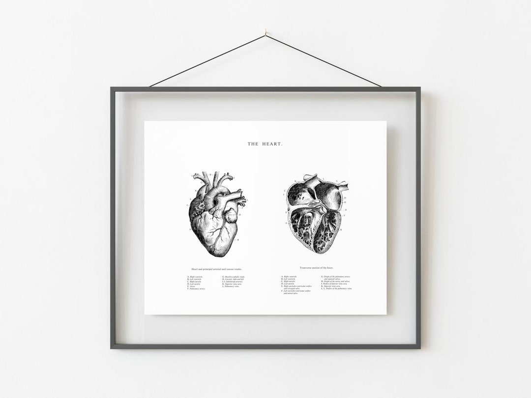 Anatomical Heart Print - Printable Wall Art - Heart Wall Art - Vintage ...