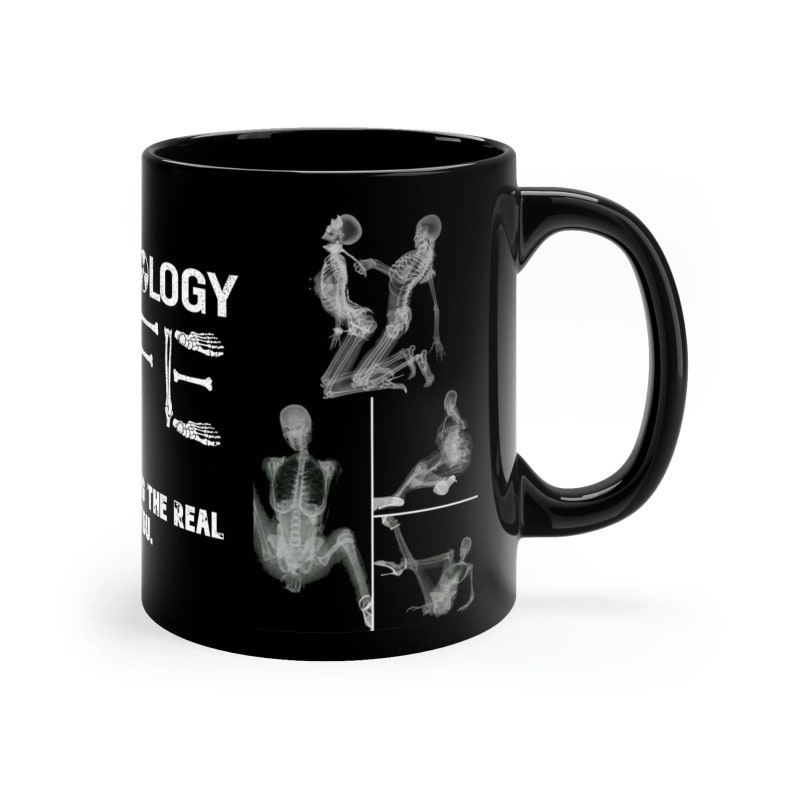 Radiology Life Design for Mug - Etsy