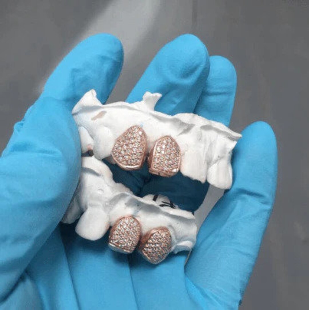 Rose Gold Diamond Grillz, Gold Diamond Teeth Grillz for Men and Women ...