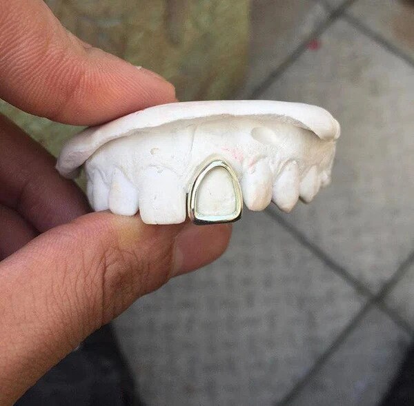 Yellow Gold Window Grillz, Gold Grillz for Men and Women, Gold Teeth ...