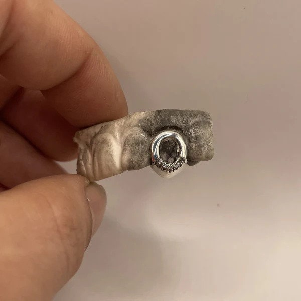 White Gold Diamond Teeth, Diamond Grillz for Men and Women, Fitted ...