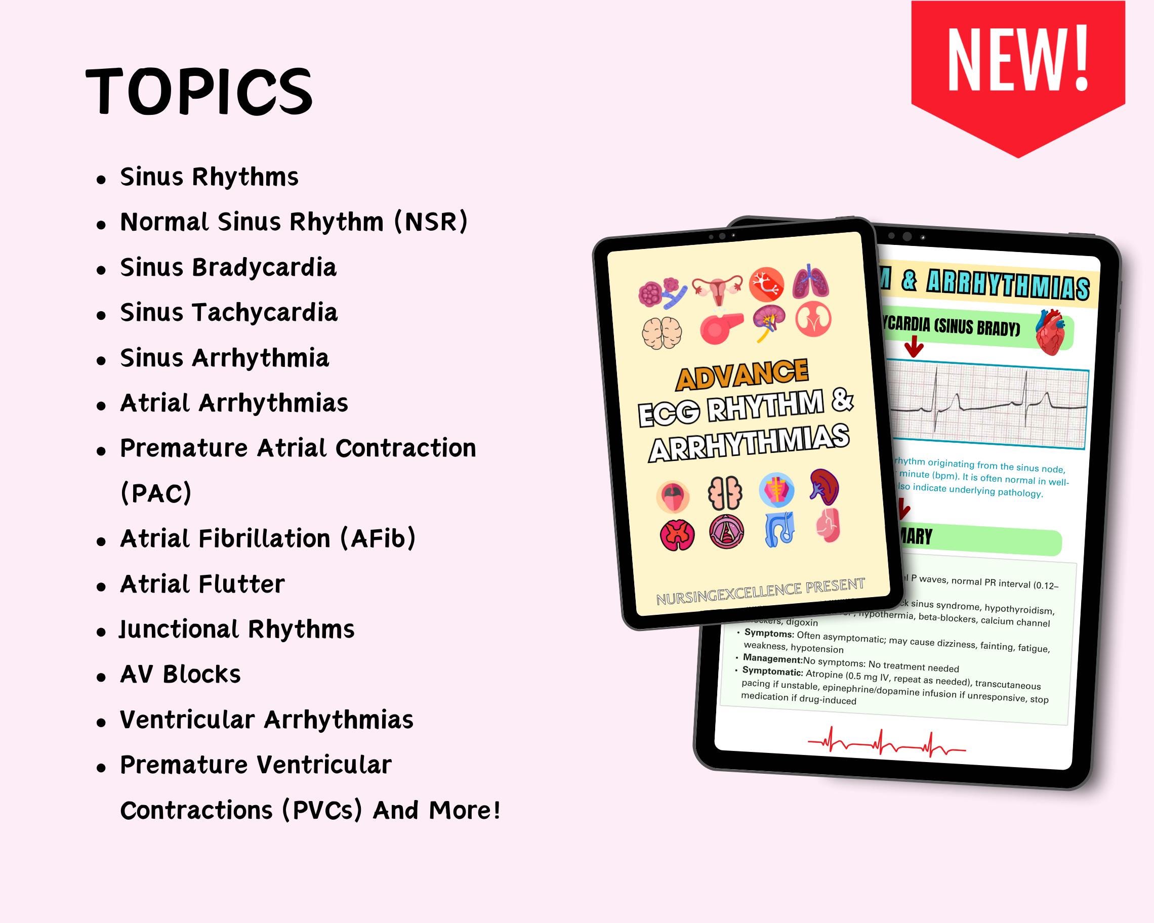 ECG Rhythm & Arrhythmias Bundle, EKG and Dysrhythmias, Cheat Sheets, 35 ...