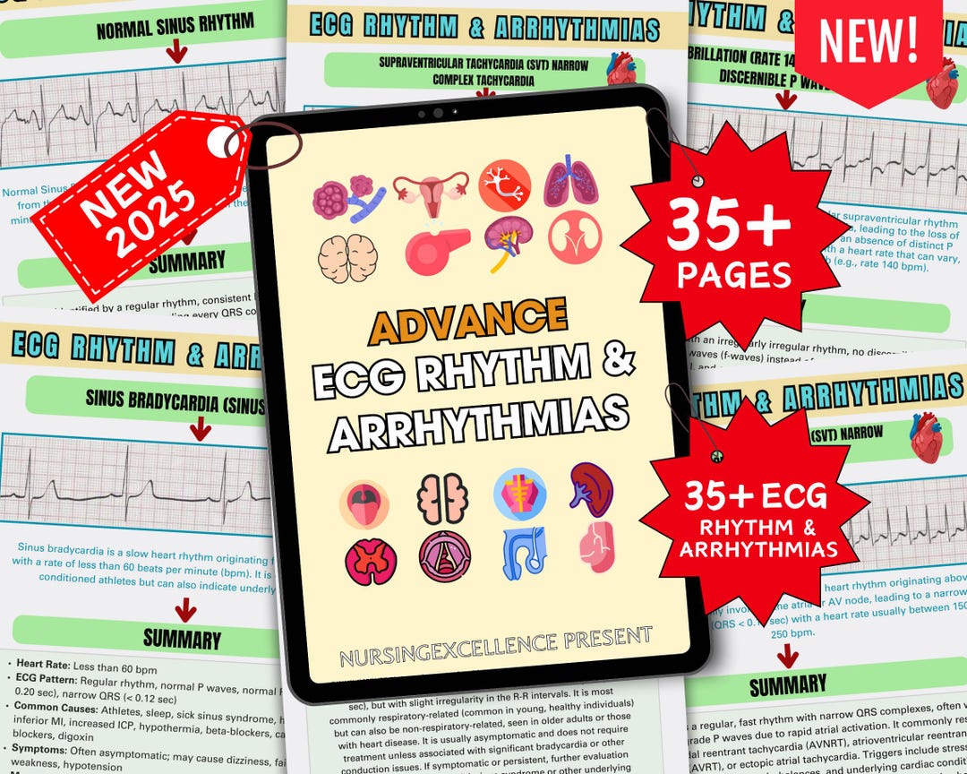 ECG Rhythm & Arrhythmias Bundle, EKG and Dysrhythmias, Cheat Sheets, 35 ...