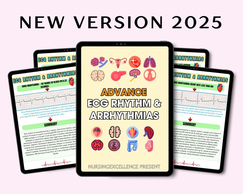 ECG Rhythm & Arrhythmias Bundle, EKG and Dysrhythmias, Cheat Sheets, 35 ...