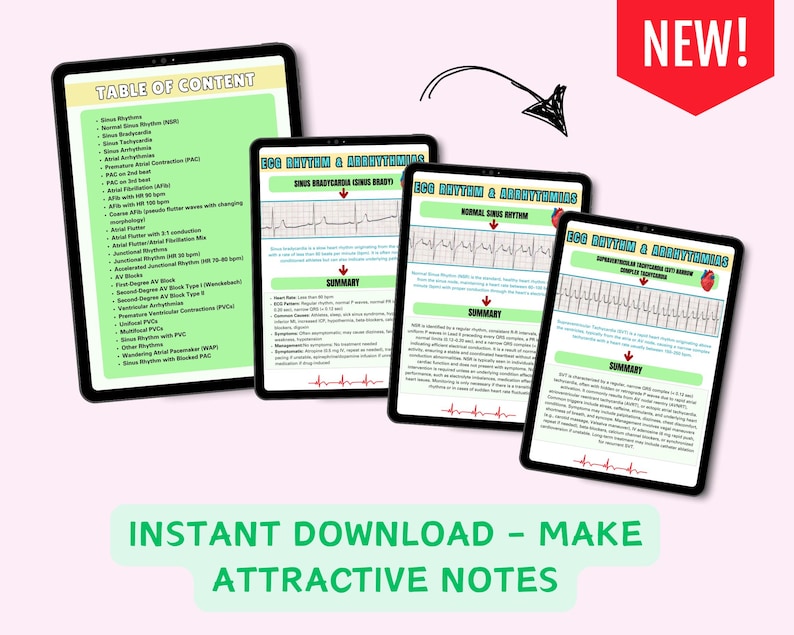 ECG Rhythm & Arrhythmias Bundle, EKG and Dysrhythmias, Cheat Sheets, 35 ...