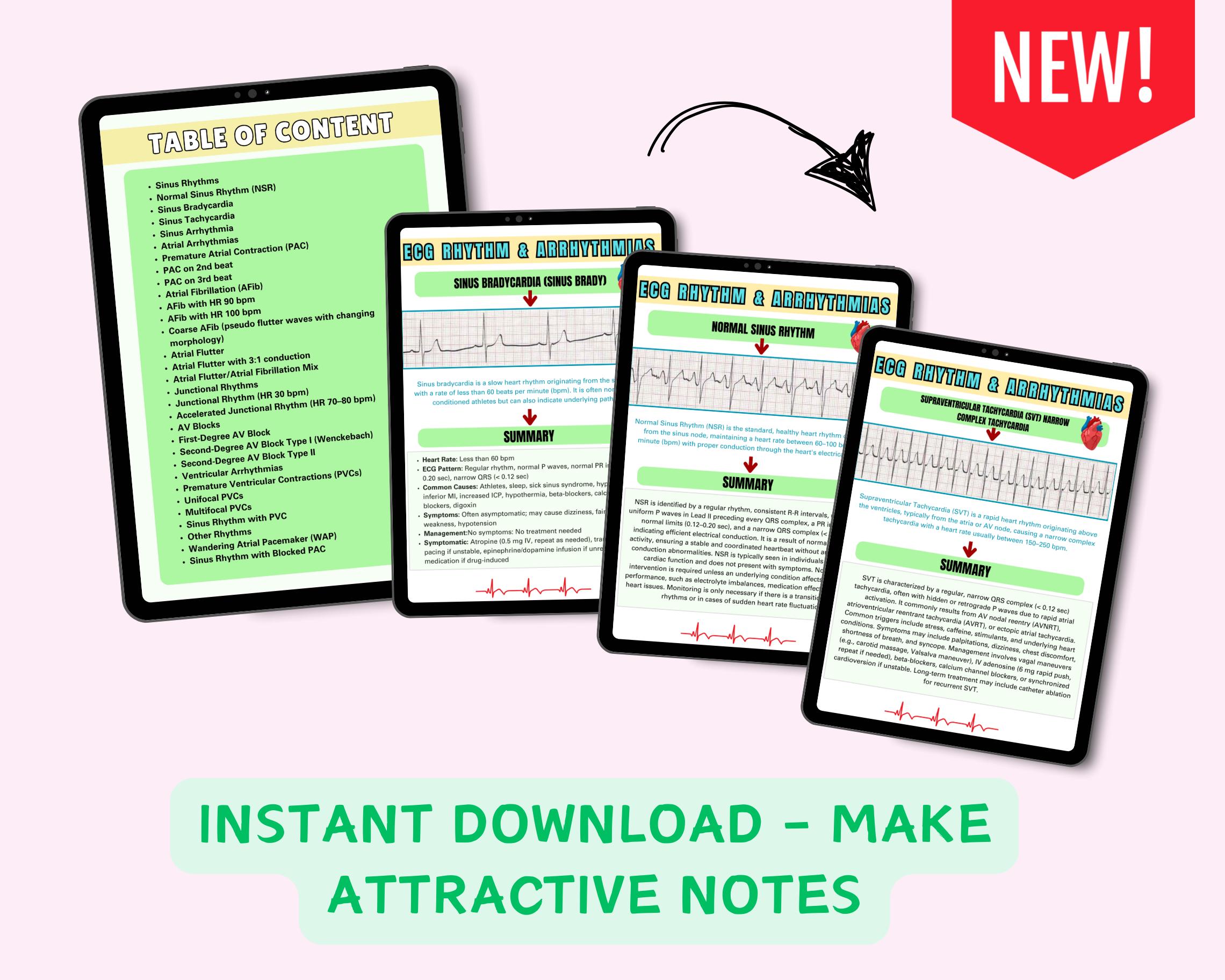 ECG Rhythm & Arrhythmias Bundle, EKG and Dysrhythmias, Cheat Sheets, 35 ...