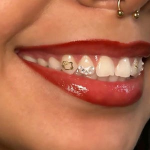 Gold Hello Kitty Tooth Gem - Etsy