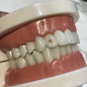 Gold Sparkle Tooth Gem - Etsy