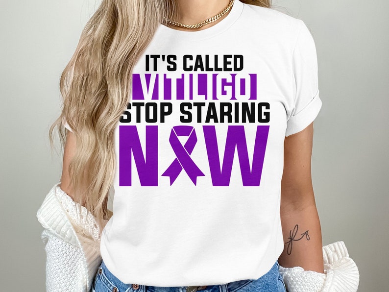 Vitiligo Awareness Svg Png, It's Called Vitiligo Stop Staring Now Svg ...