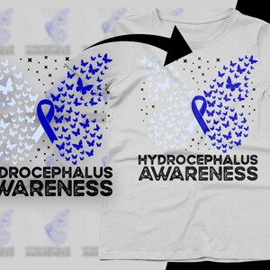 Hydrocephalus Awareness Butterfly Svg, Light Blue Ribbon Support ...