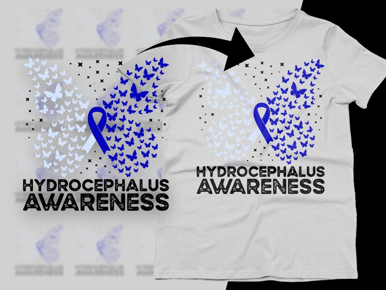 Hydrocephalus Awareness Butterfly Svg, Light Blue Ribbon Support ...