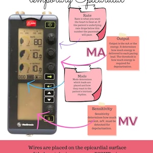Nursing Notes, Temporary Pacemaker Cheat Sheet, Epicardial Pacemakers ...