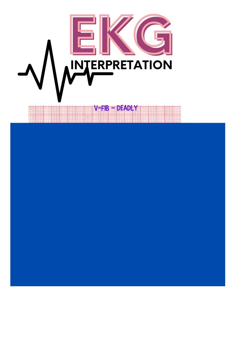 EKG Interpretation, Easy Steps for Ekg, Nursing Notes, Nursing Made ...