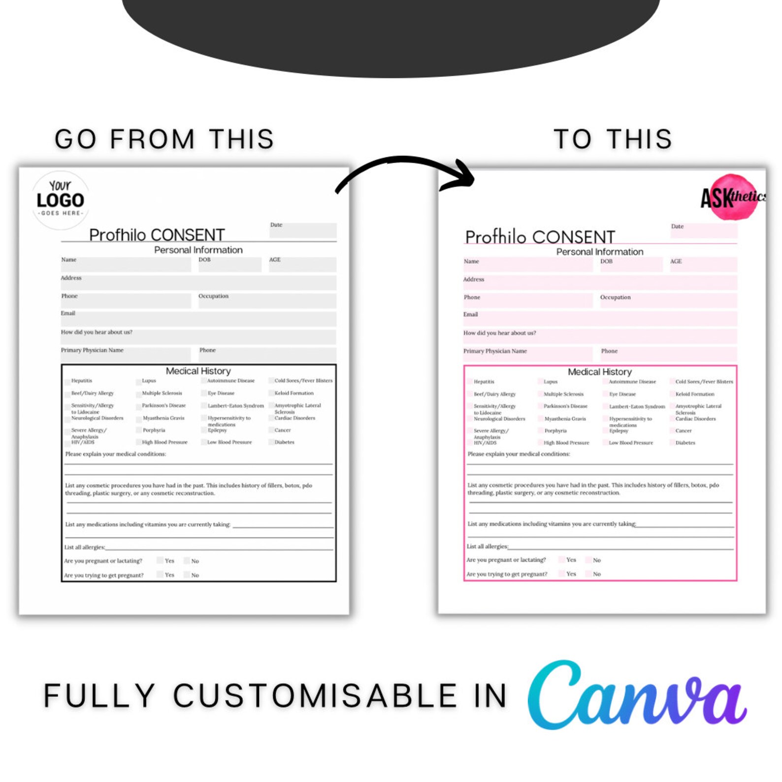 Editable Profhilo Consent Form for Aesthetic Practitioners/clinics - Etsy