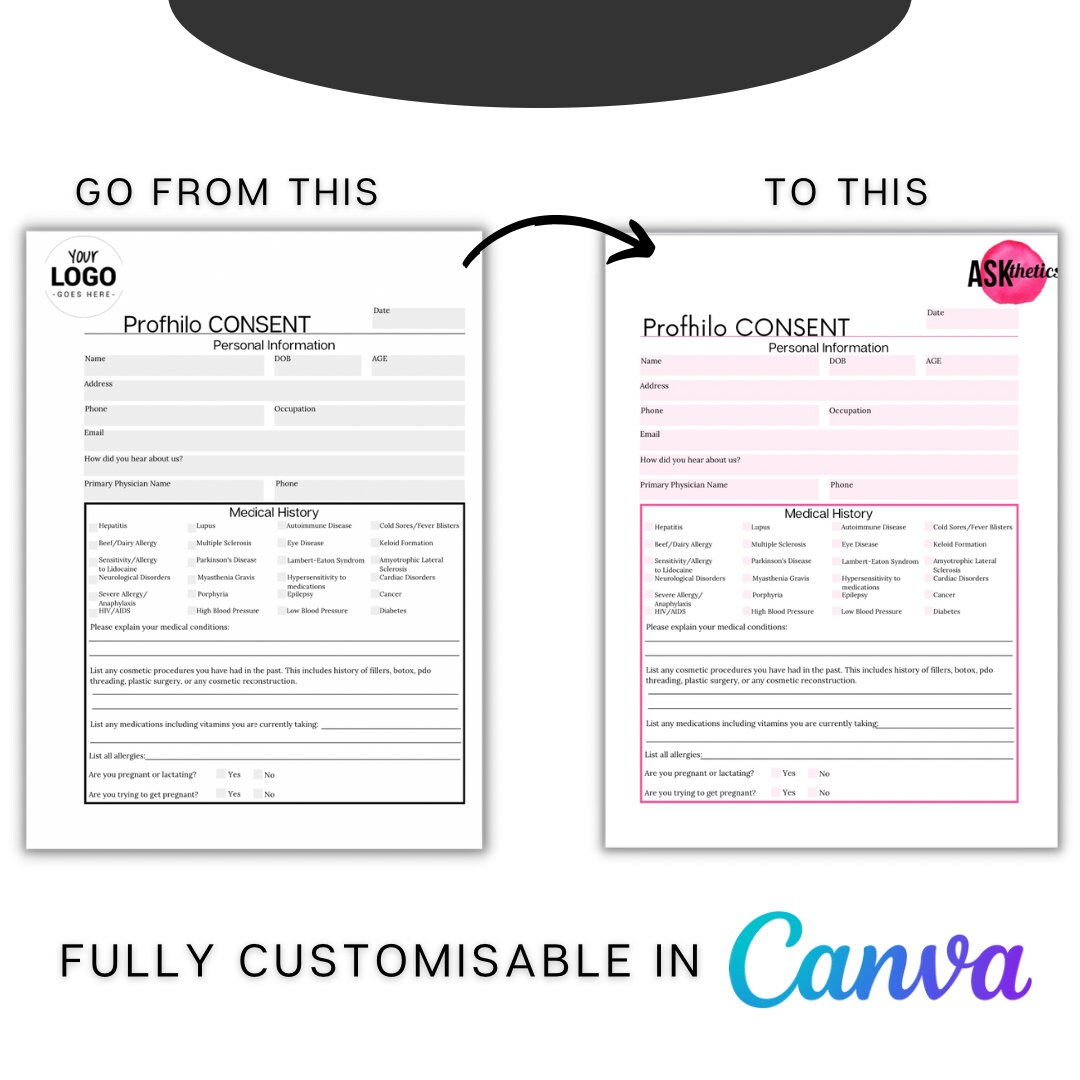 Editable Profhilo Consent Form for Aesthetic Practitioners/clinics - Etsy