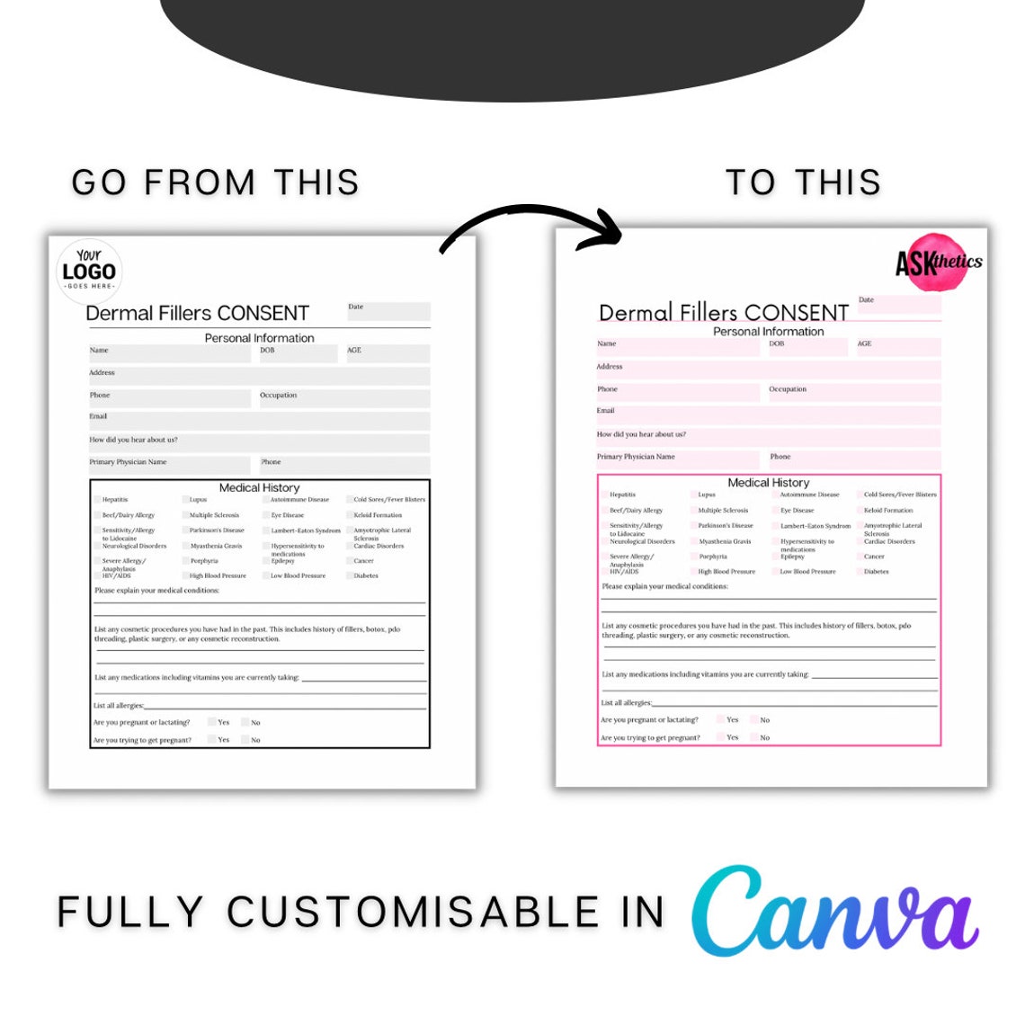 Editable Dermal Fillers Injections Consent Form for Aesthetic ...