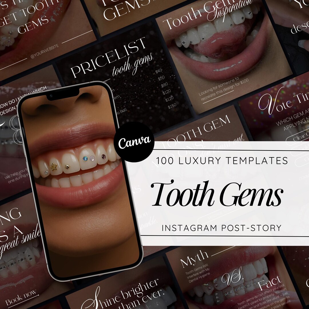 Tooth Gem Instagram Templates | Dental Clinic Social Media Kit | Canva ...