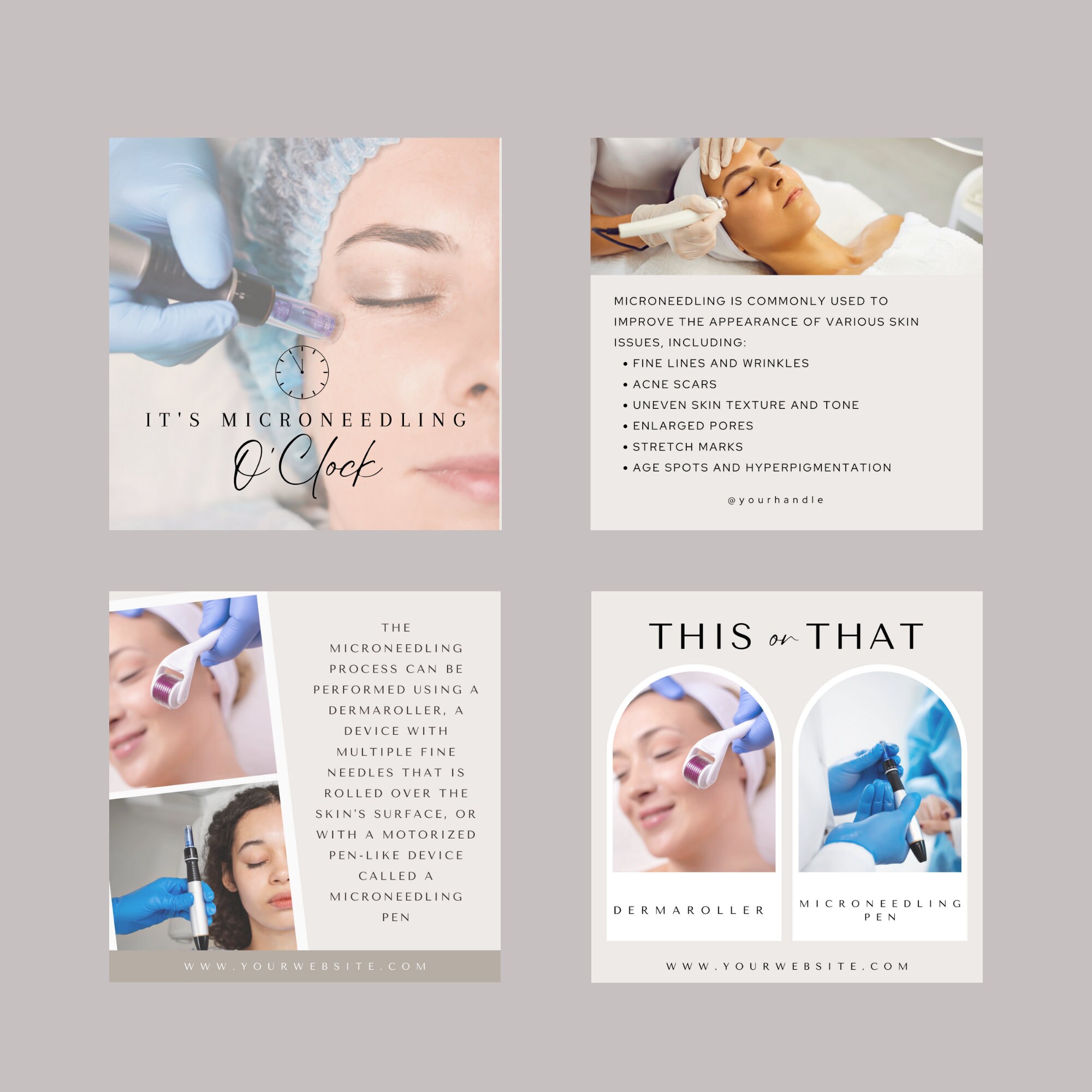 Microneedling Instagram Template, Esthetician Posts, Facial Scalp ...
