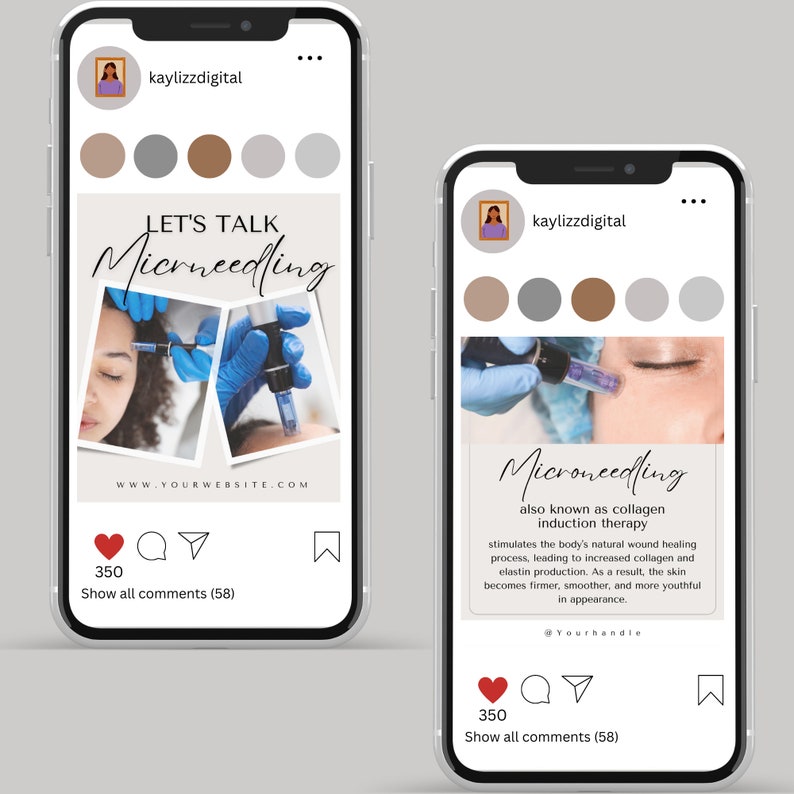 Microneedling Instagram Template, Esthetician Posts, Facial Scalp ...