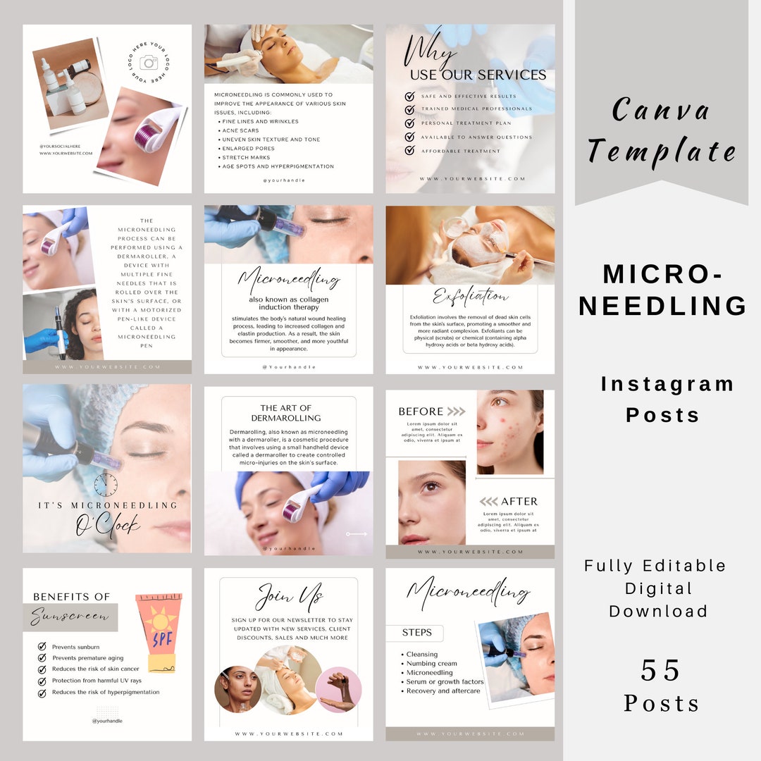 Microneedling Instagram Template, Esthetician Posts, Facial Scalp ...