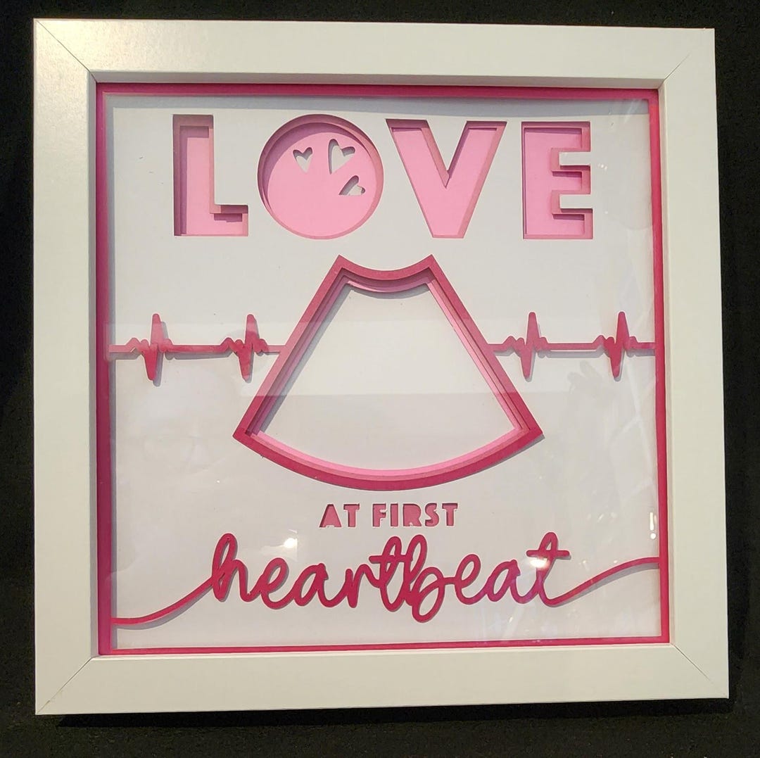 Love at First Heartbeat Shadow Box - Etsy