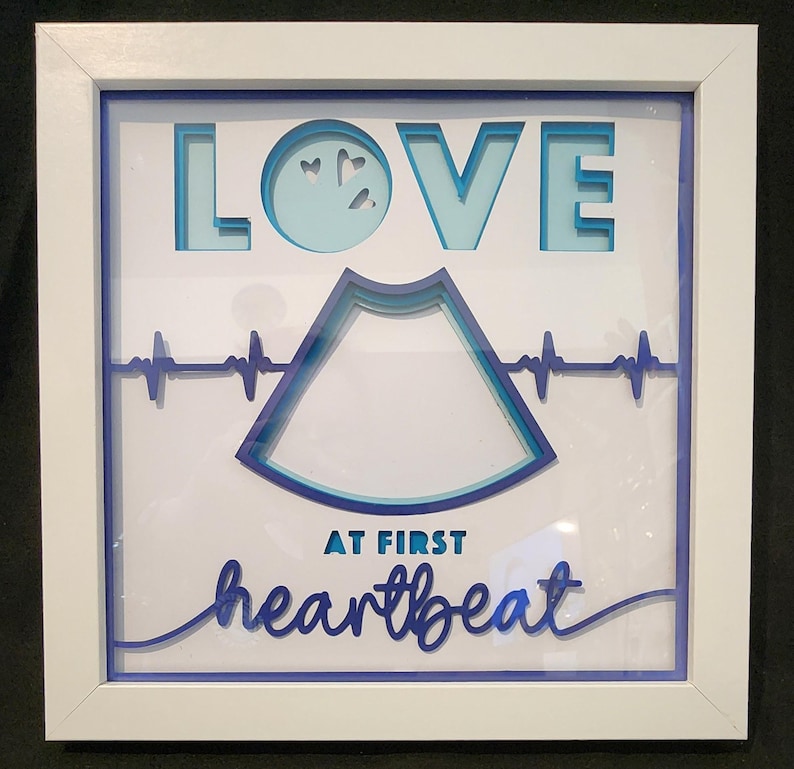 Love at First Heartbeat Shadow Box - Etsy
