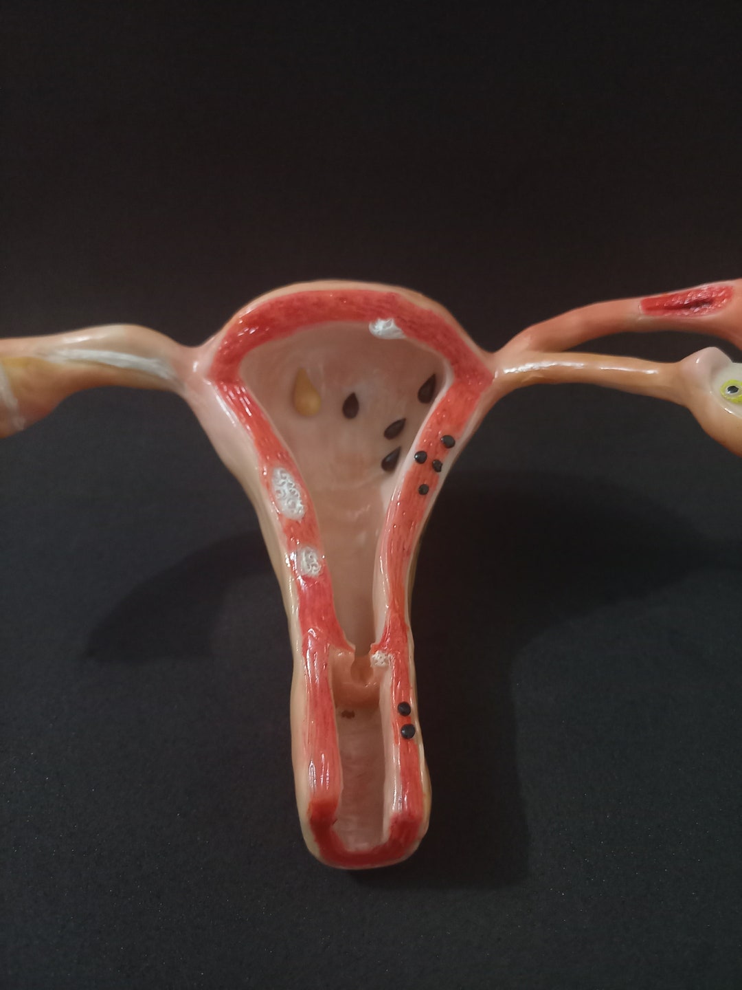 Uterus Ovaries Anatomical Model 30 Cm Plus Gift - Etsy