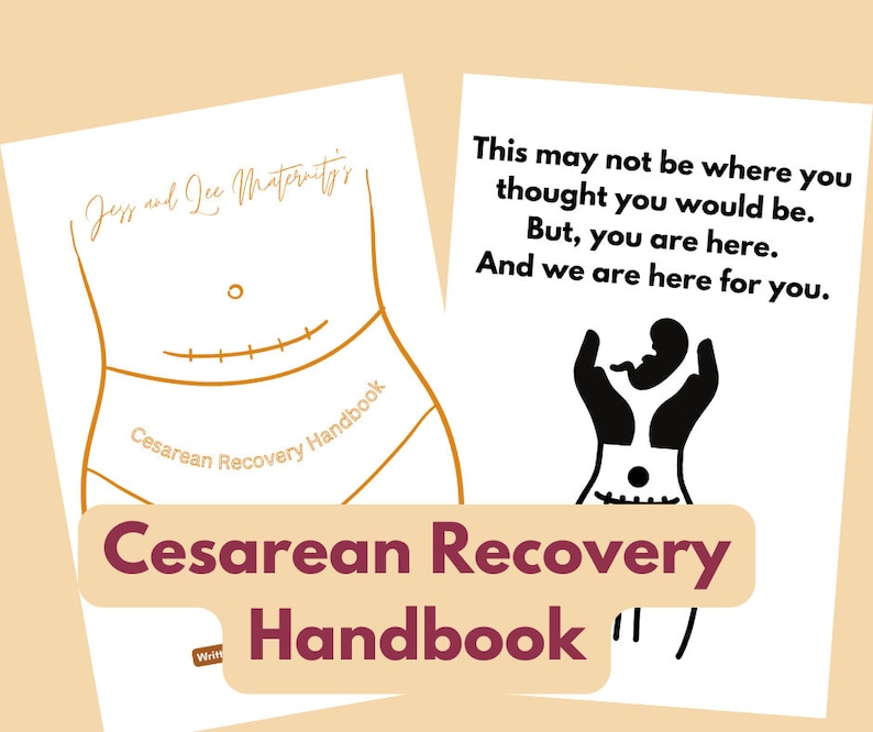 Cesarean Birth Recovery Handbook A Guide for Optimal C Section Recovery ...