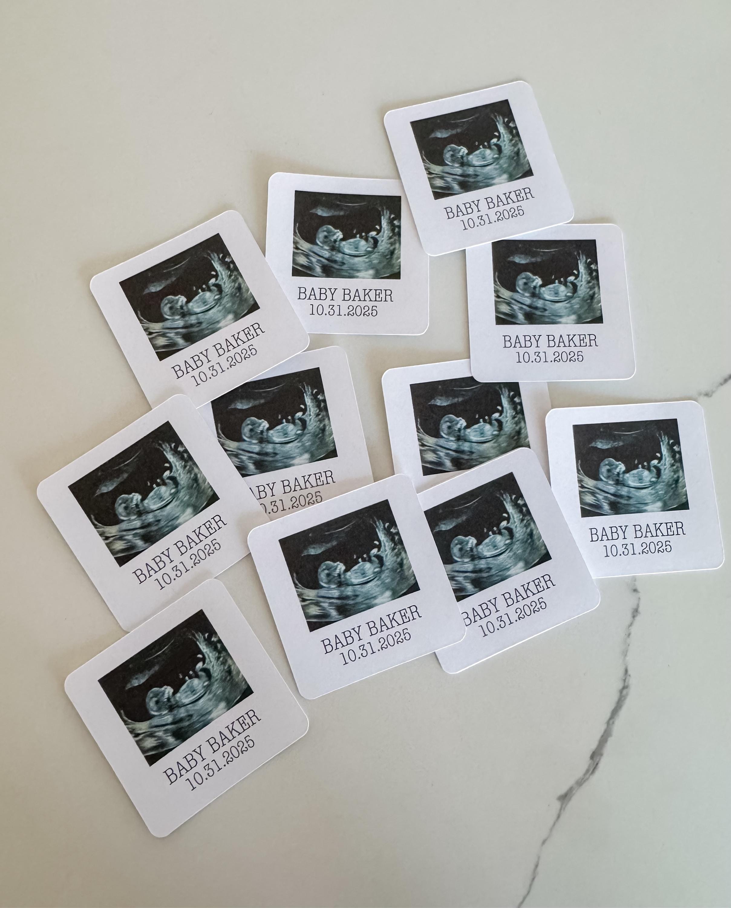 Ultrasound Baby Shower Decorations, Ultrasound Confetti, Custom ...