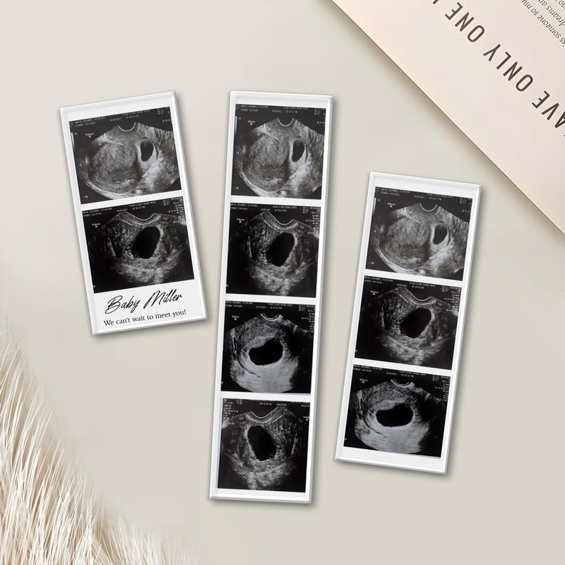 Custom Ultrasound Photo Strip Acrylic Magnet, Baby Announcement - Etsy