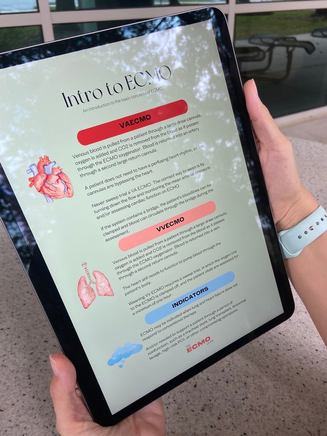 Introductory ECMO Fact Sheet. Basic Understanding of What ECMO is and ...