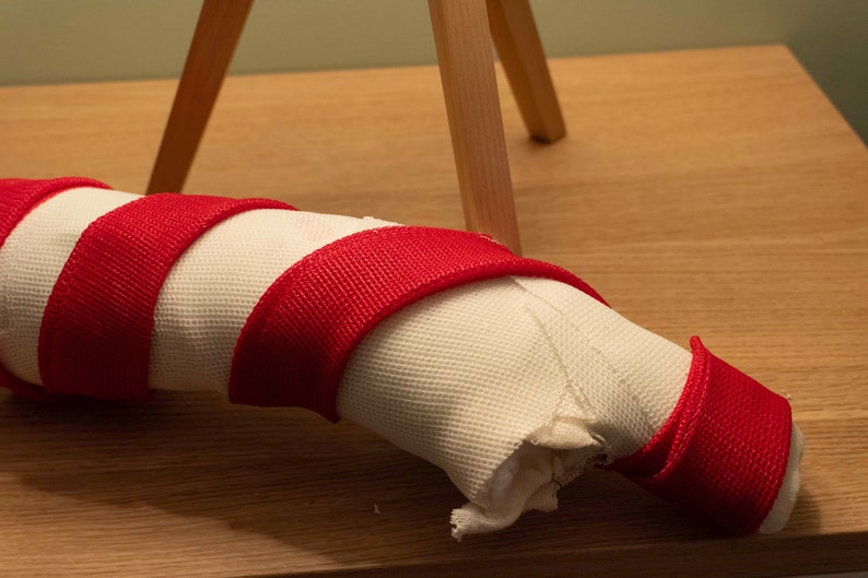 Short Arm Finger Spica Cast Candy Cane Pattern Worn - Etsy