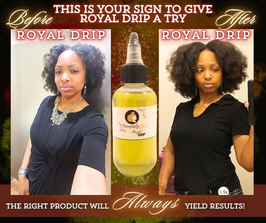 Royal Drip Hair Growth Oil, Vegan Care for Thick, Full Hair - Anti ...