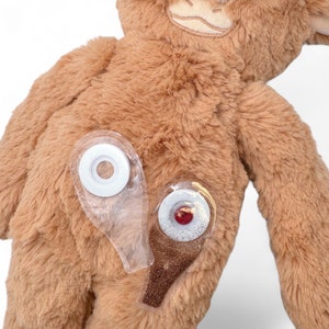 Toy Stoma and Ostomy Bag - Etsy